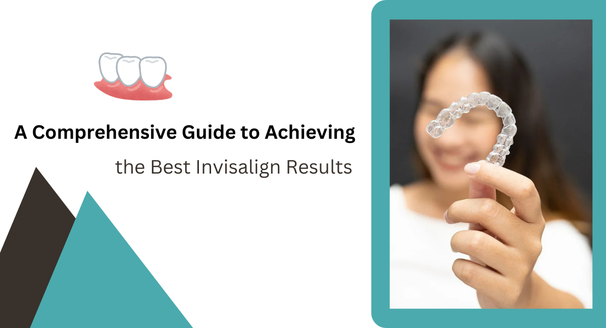 A Comprehensive Guide to Achieving the Best Invisalign Results