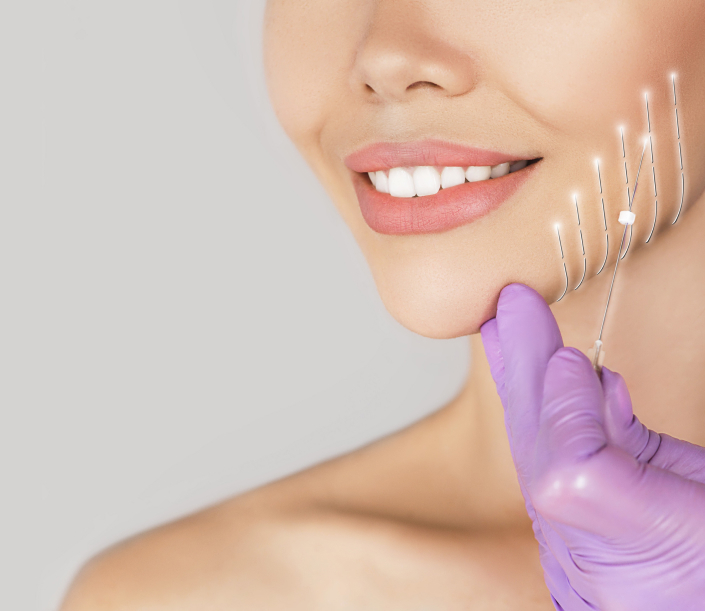 Cosmetic Thread Lift Islamabad: Patient Testimonials