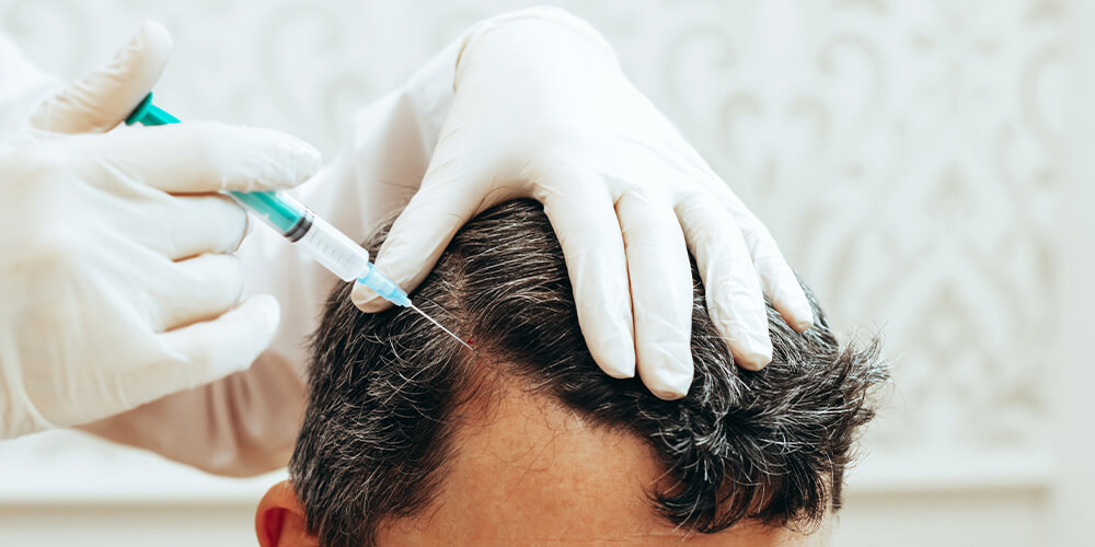 Does PRP Hair Treatment Really Work? What the Research Says